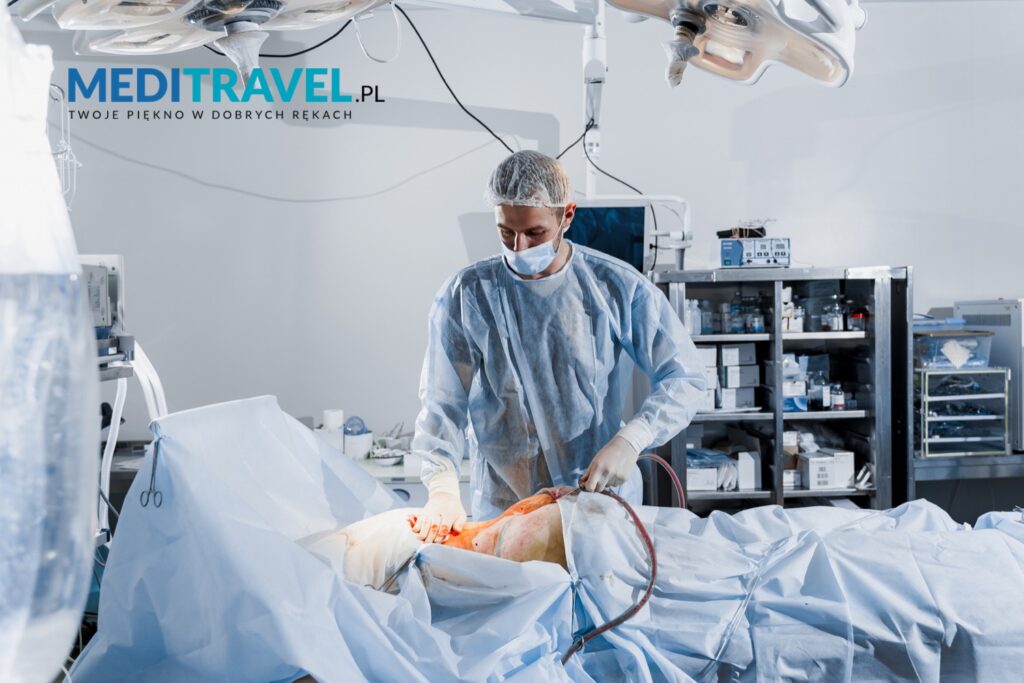 5 secrets of a good liposuction surgery in Turkey - Meditravel.com